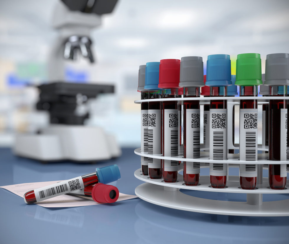 Blood Chemistries - Genesis Reference Labs